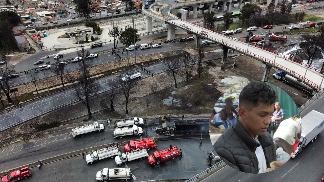 Erick podría perder manos y vista tras explosión en Iztapalapa